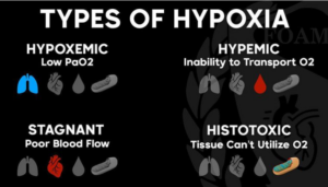 Hypoxia – Tommy's Diaries